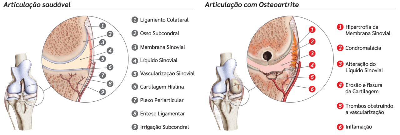 Cartrophen Cães - Cartrophen